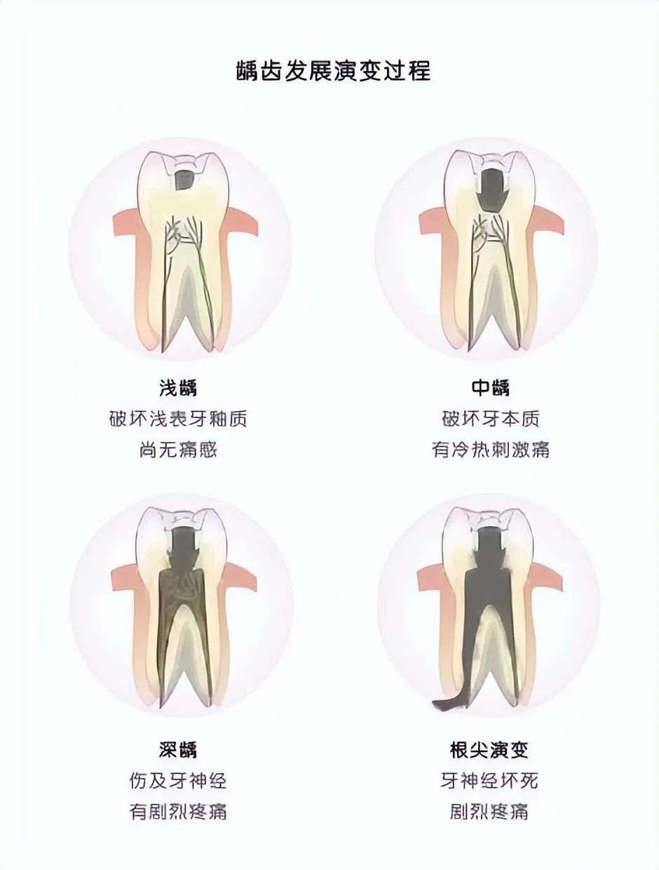Cariostat龋易感检测——牙齿的好朋友 - 汉中口腔医院-专业口腔诊疗服务提供商